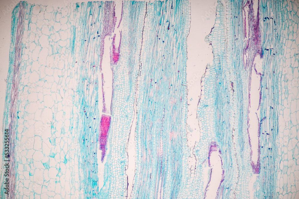Plant tissue Structure, section (tissue) of stem plant tissue under a ...