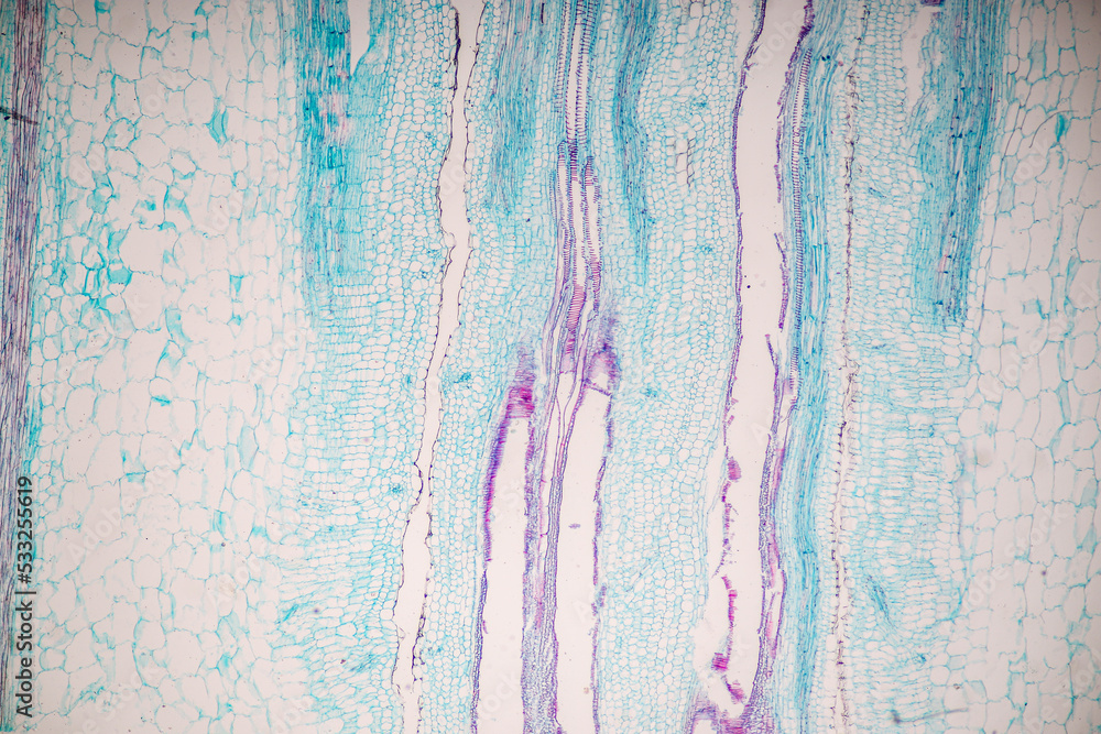 Plant tissue Structure, section (tissue) of stem plant tissue under a ...