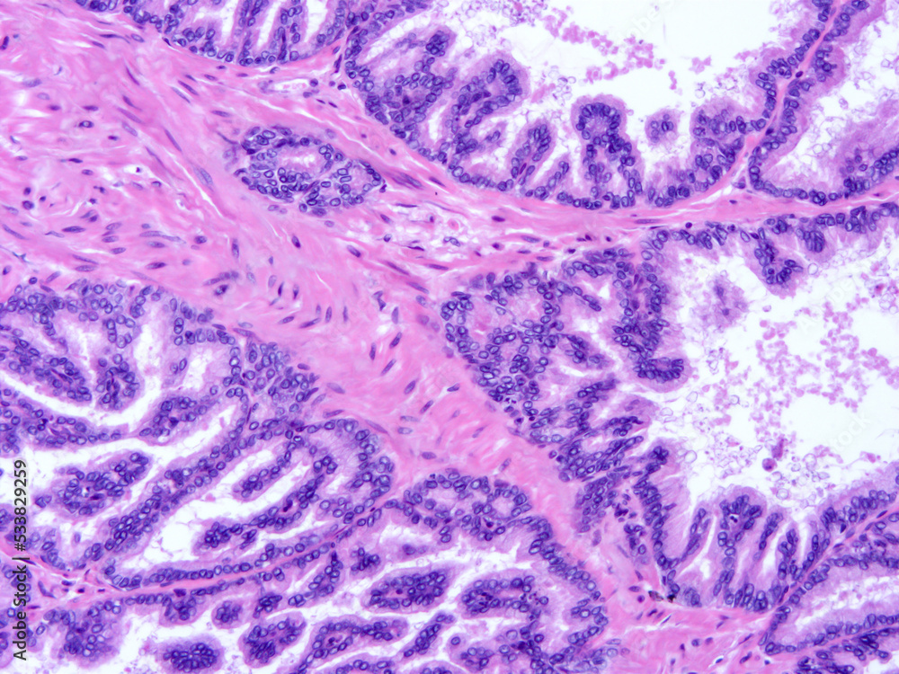 Histology of human tissue, show epithelial tissue and connective tissue ...