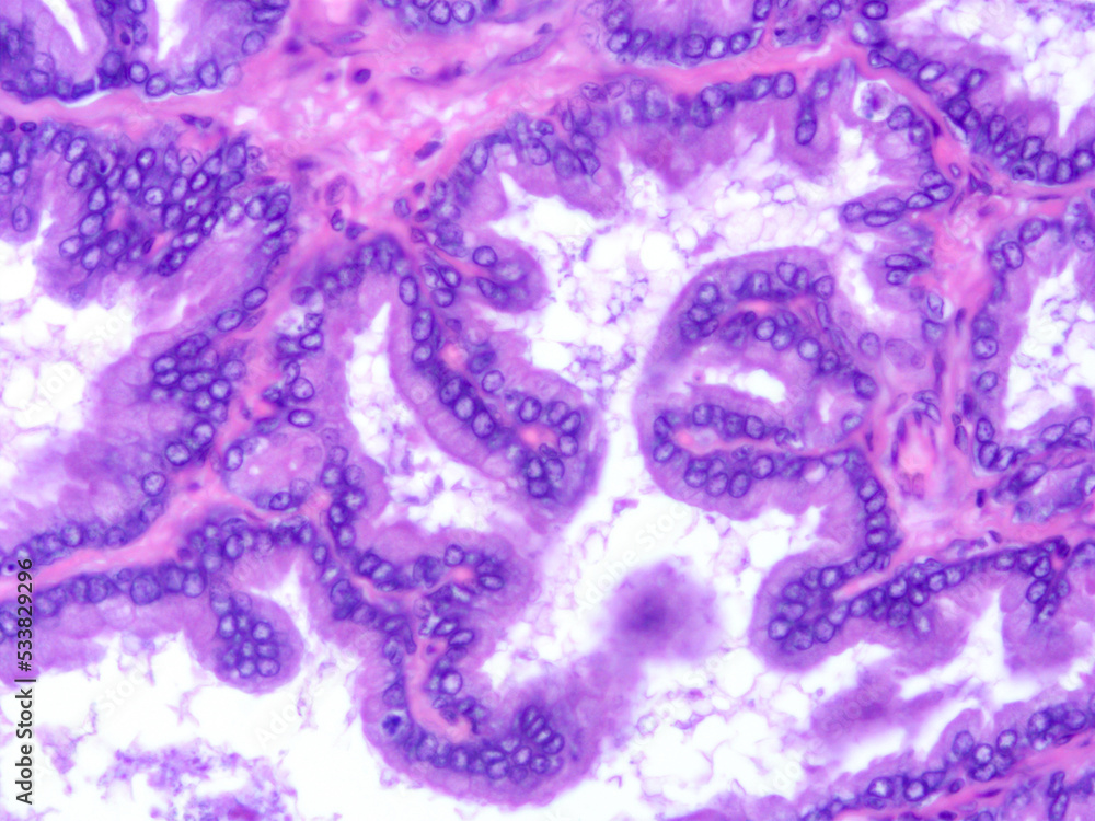 Histology of human tissue, show epithelial tissue and connective tissue ...