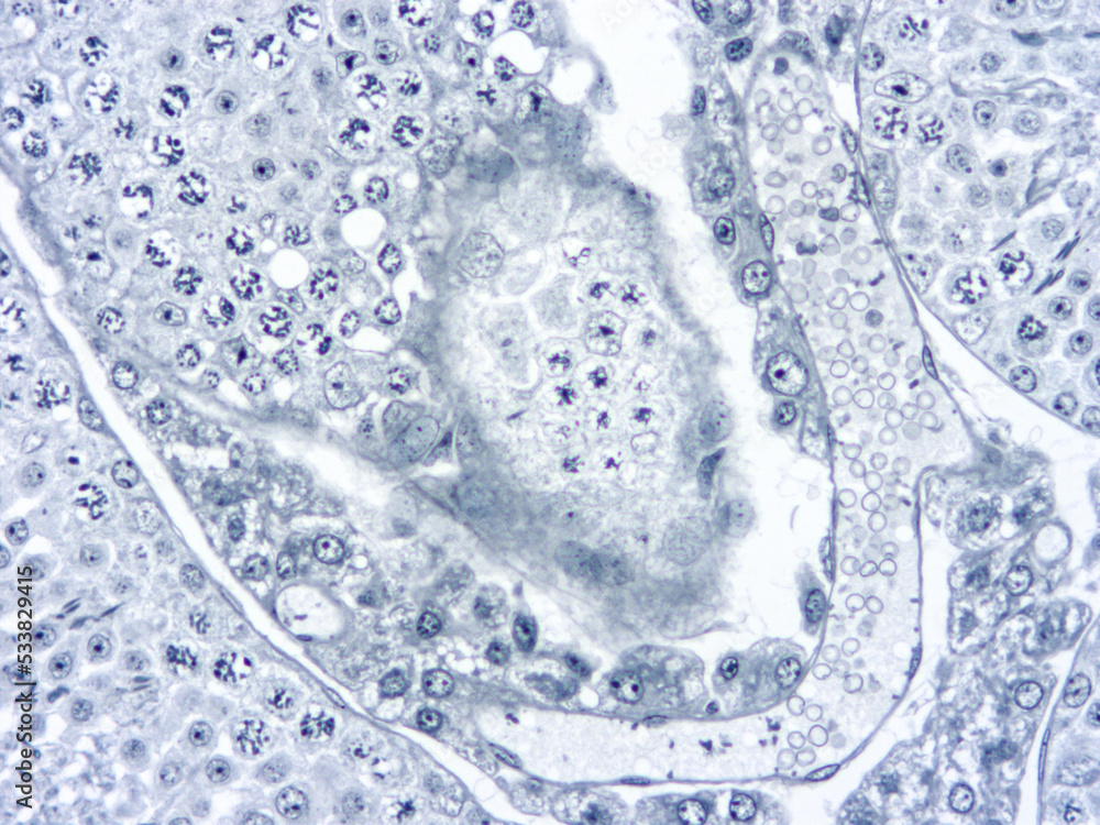 Histology of human tissue, show epithelial tissue and connective tissue ...