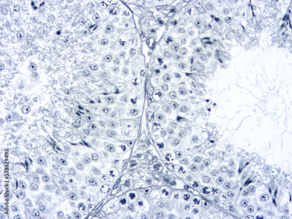 Histology of human tissue, show epithelial tissue and connective tissue ...