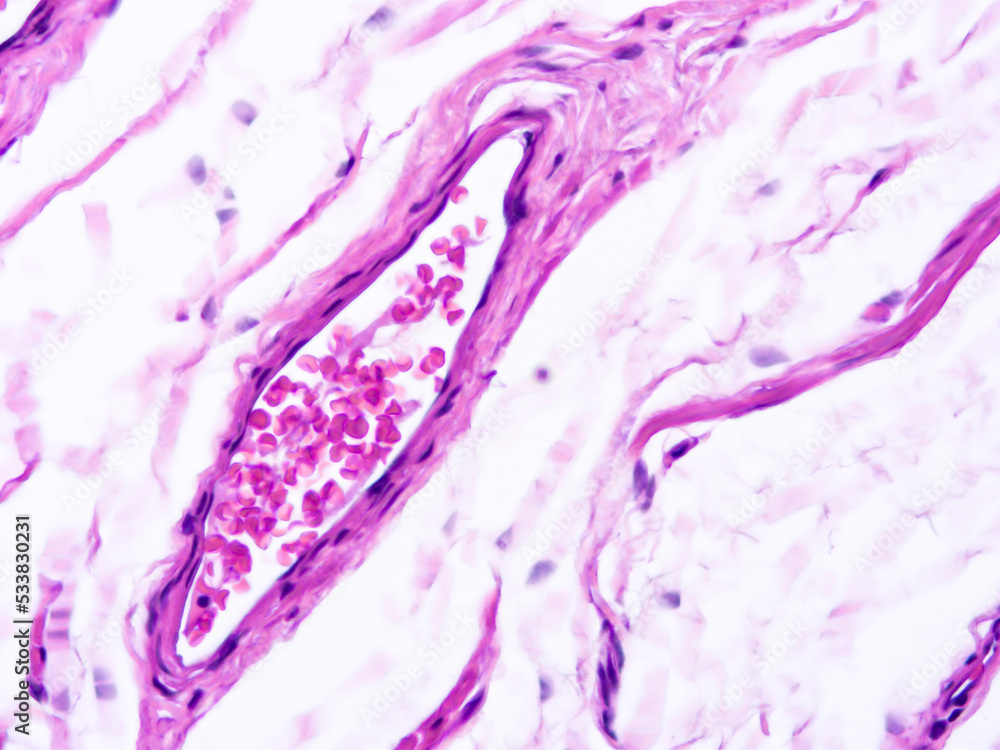 Histology of human tissue, show epithelial tissue and connective tissue ...