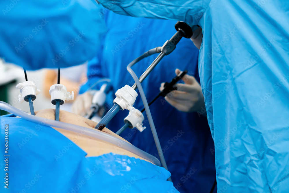 Laparoscopic surgical equipment during proctological minimally invasive ...
