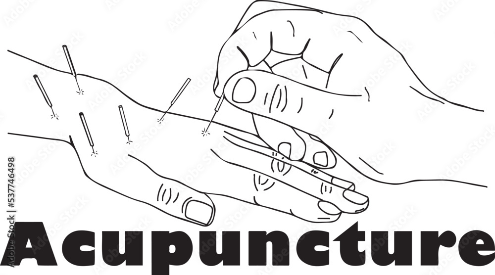 acupuncture sketch hand drawing outline vector illustration ...