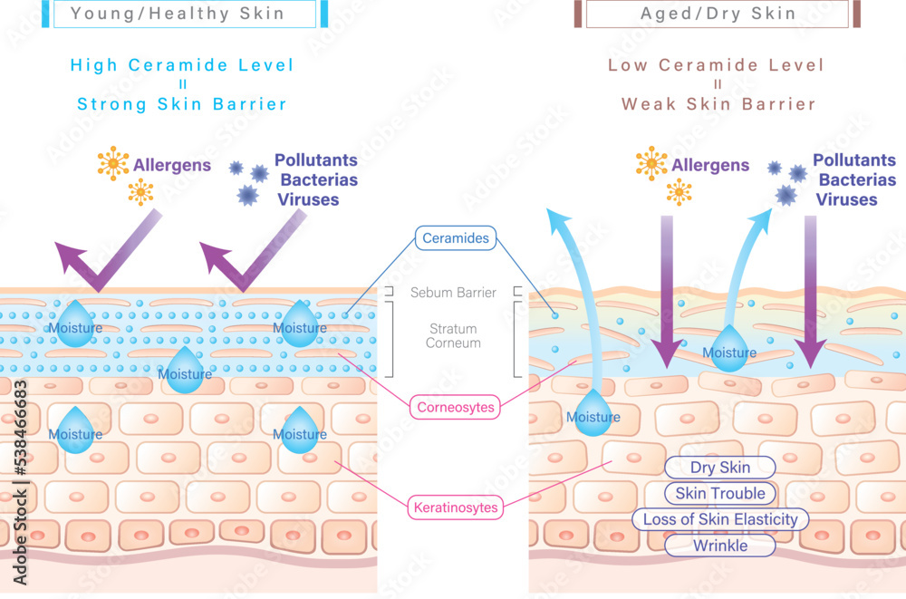 Ceramide in skin and skin barrier illustration comparing between young ... Ceramide in skin and skin barrier illustration comparing between young ...