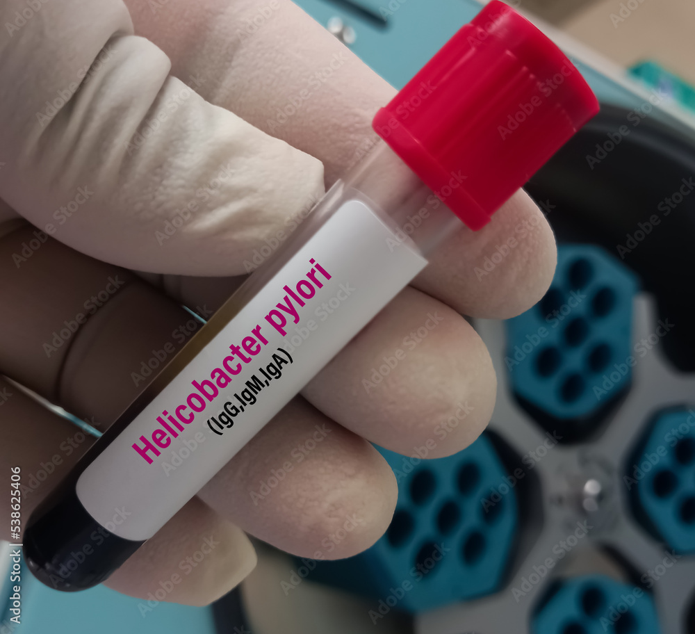 Fotografie Blood sample for H. Pylori (IgA, IgG and IgM) test ...