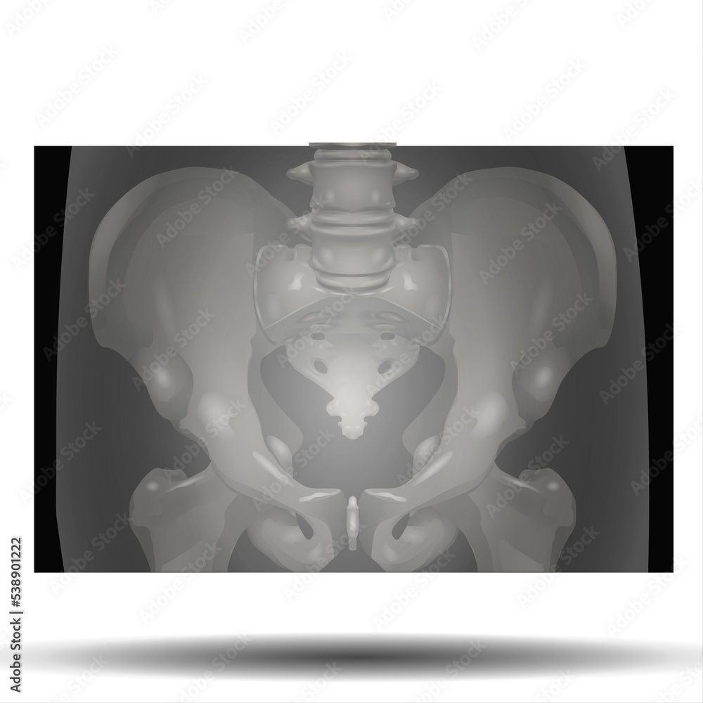 X-Ray of Pelvis - Fla source file available - Structure of the pelvis ...
