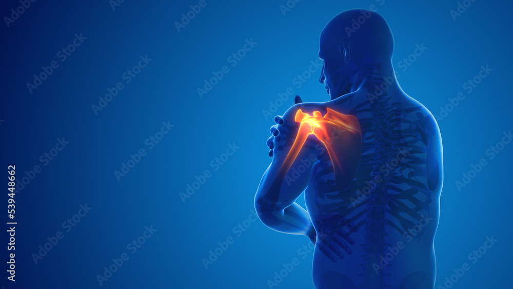 Pain in the shoulder joint Stock Illustration | Adobe Stock