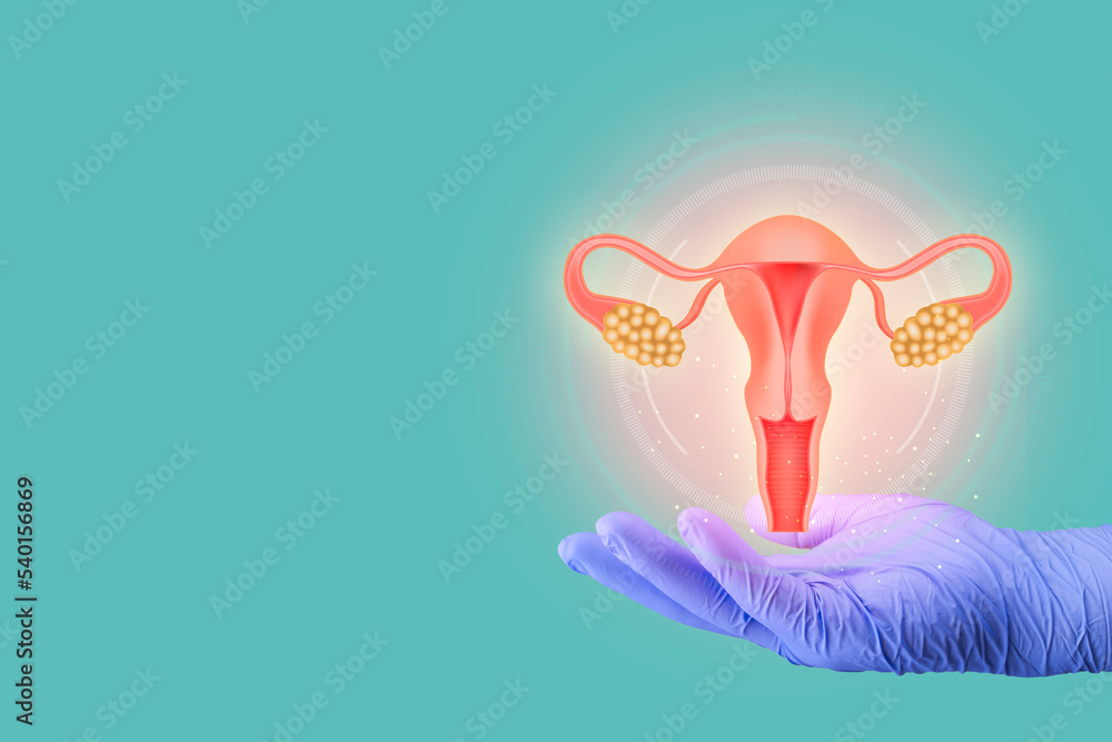 Female reproductive health concept. endometriosis, PCOS, gynecological ...