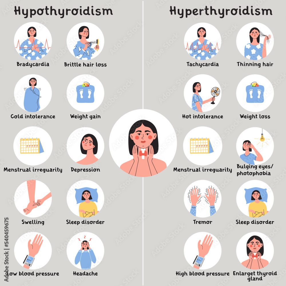 Hypothyroidism and hyperthyroidism symptoms. Thyroid gland problem with ...