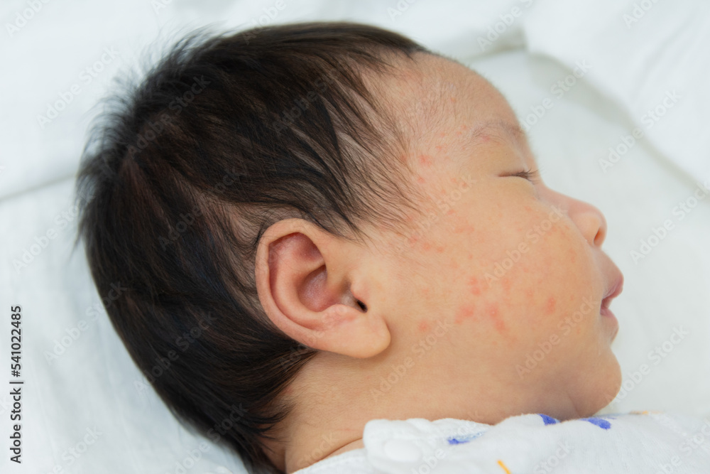 portrait of the face of a newborn baby with red cheeks with small ...
