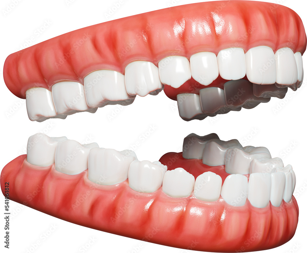 Human jaw on a transparent background. Teeth, side view, 3d rendering ...