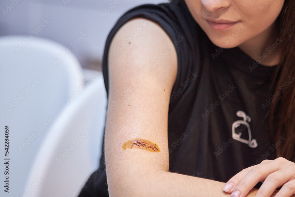 the girl looks at the wound after surgery, surgical suture, wound on ...