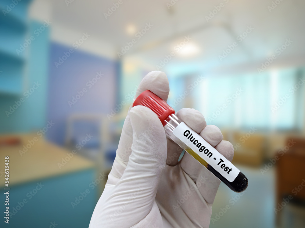 Scientist holds blood sample for Glucagon test with patient bed ...