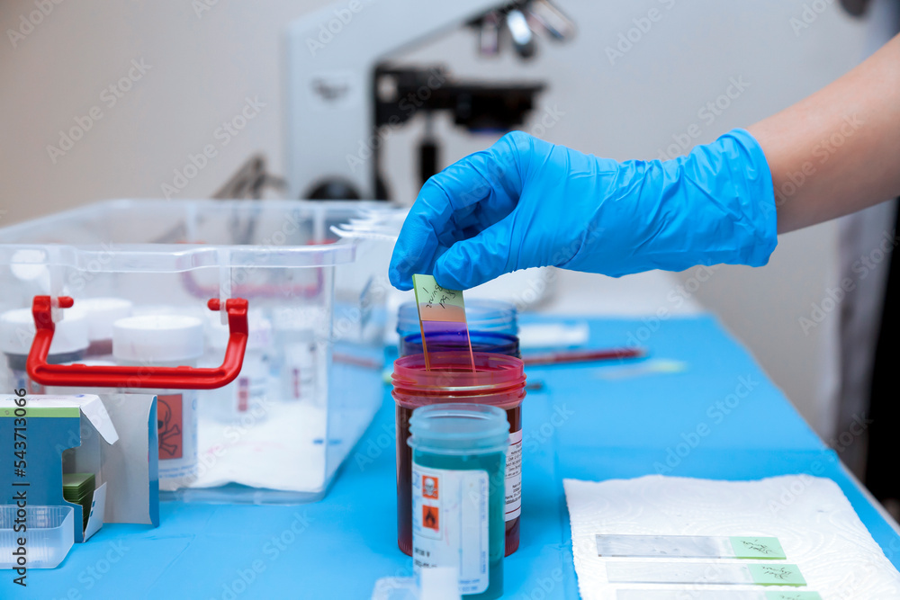 Photo Stock Histopathology stained slide which is ready for microscopic ...