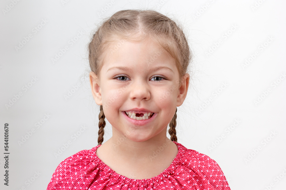 Toothless serious child without upper teeth on white background Stock ...
