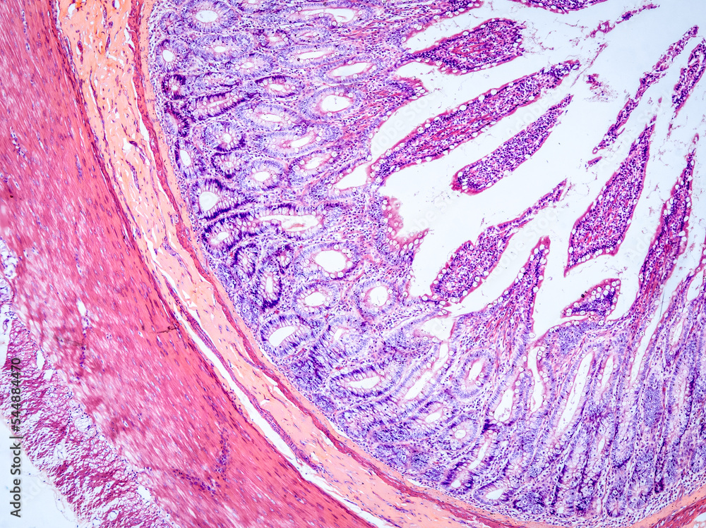 small intestine cross section under the microscope - optical microscope ...