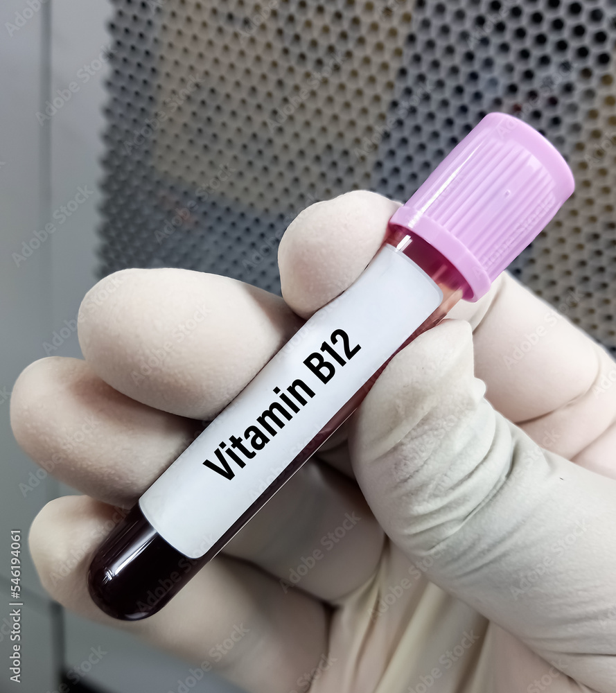 Blood sample for Vitamin B12(Cobalamin) test, to diagnose Vitamin B12 ...