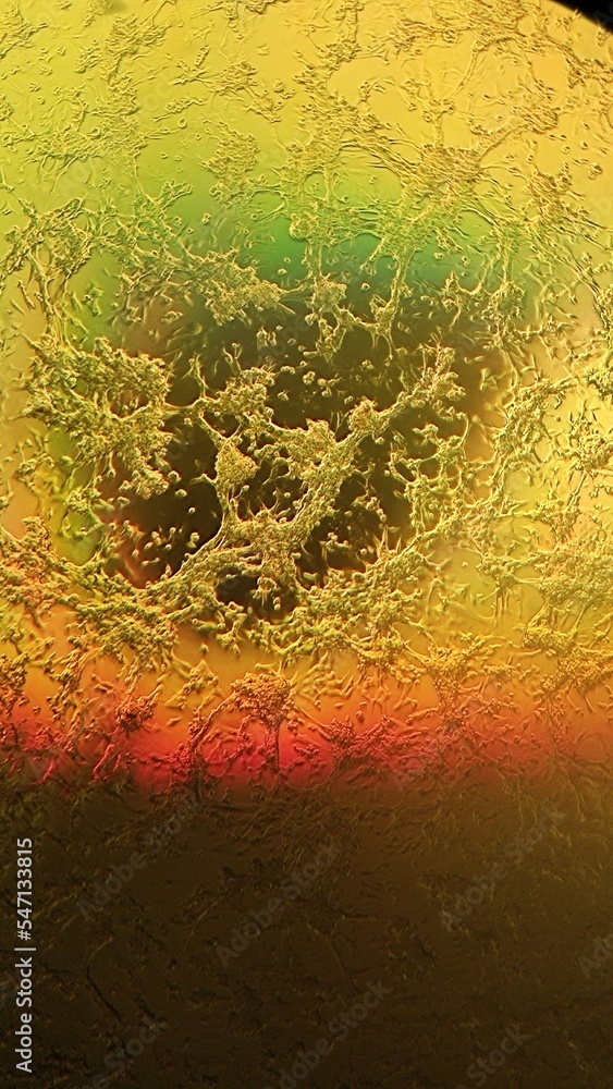 Colorful cell culture of VERO cells under the phase-contrast microscope ...