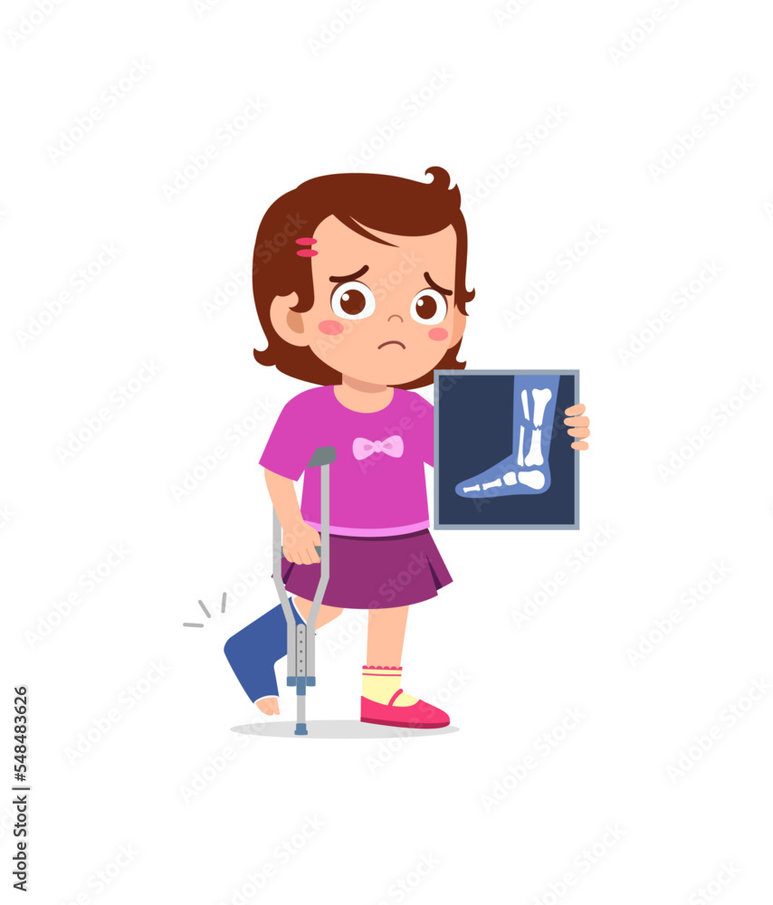 little kid got accident and got bone fracture Stock Vector | Adobe Stock
