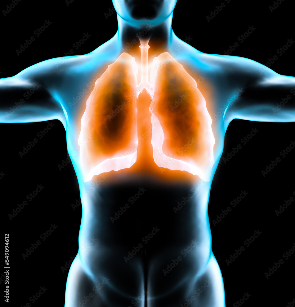 Human anatomy, problems with the respiratory system, severely damaged lungs. Bilateral pneumonia ...