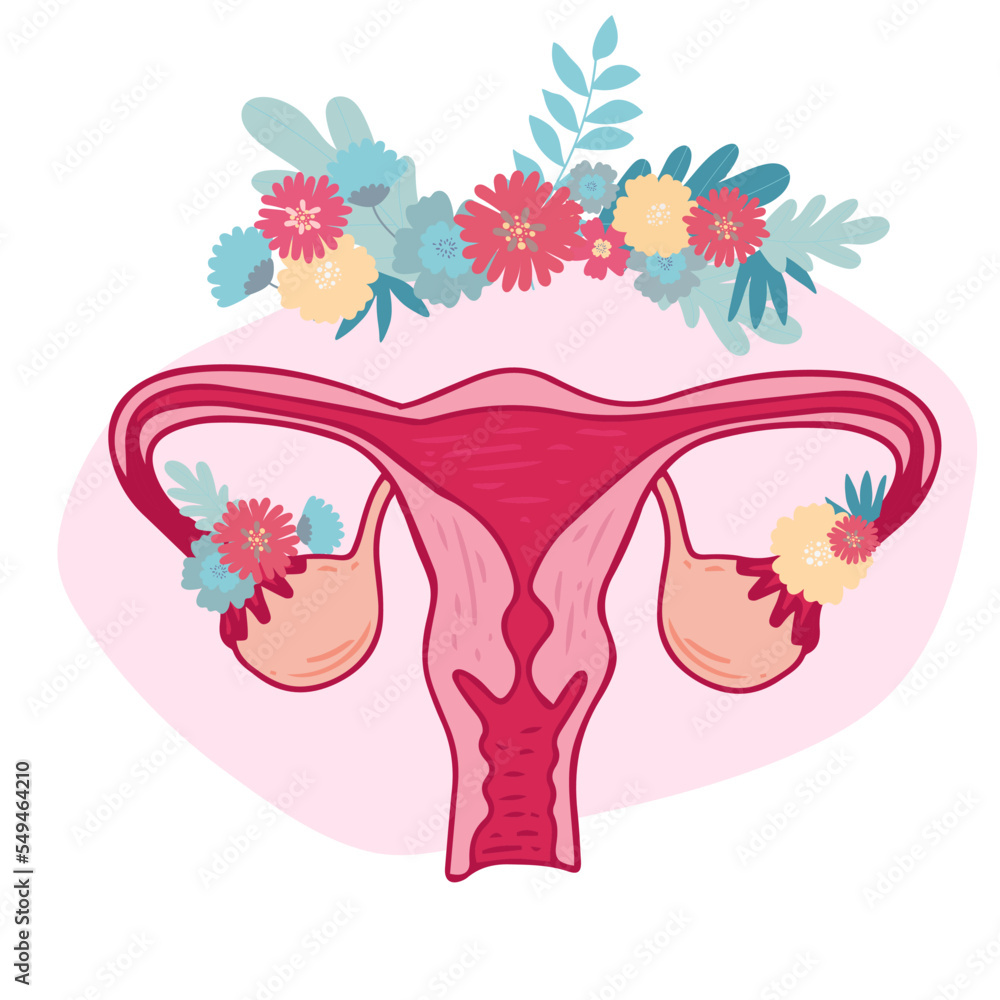Vector de Stock Women health - Floral Infographic of Polycystic ovary ...