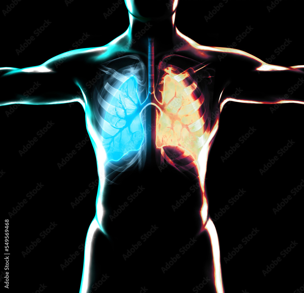 Human anatomy, human body divided in half: healthy lungs and bronchi ...