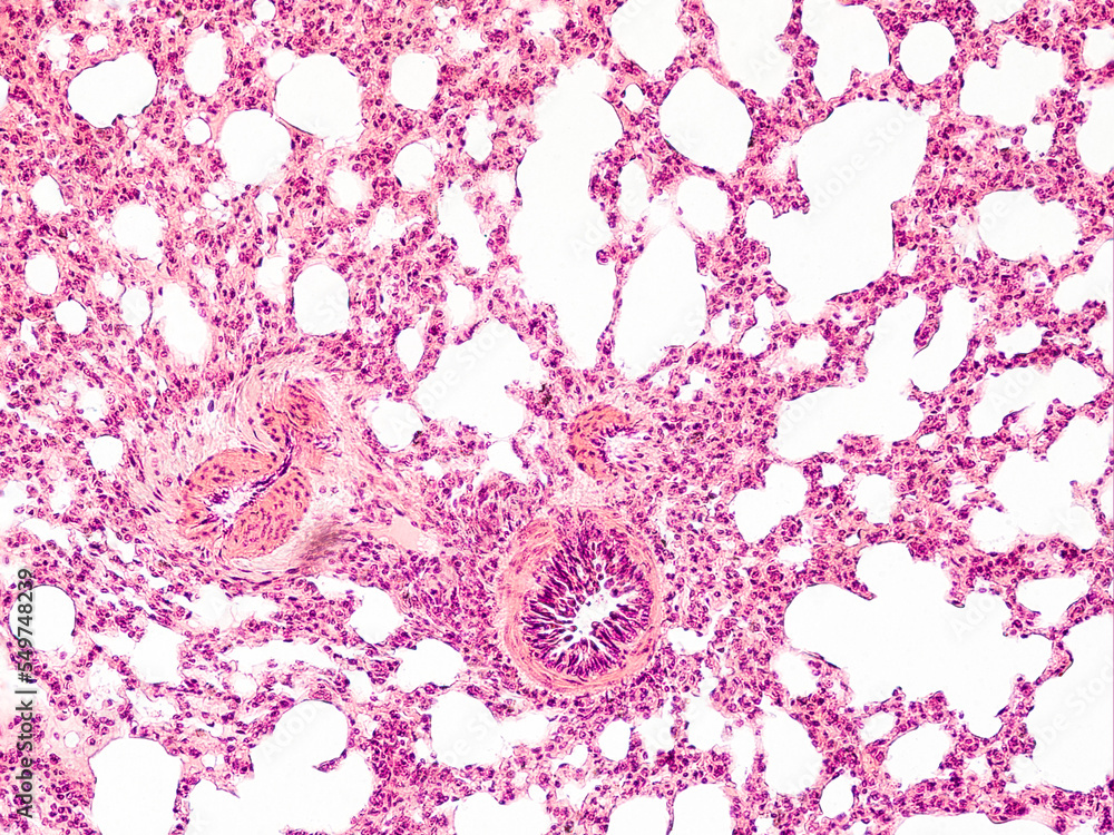 Foto guinea pig lung transverse section under the microscope - optical ...