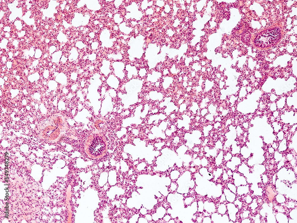 guinea pig lung transverse section under the microscope - optical ...