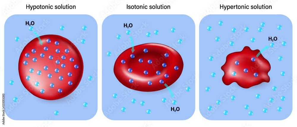 Hypotonic, Isotonic and Hypertonic solutions vector. Tonicity and ...