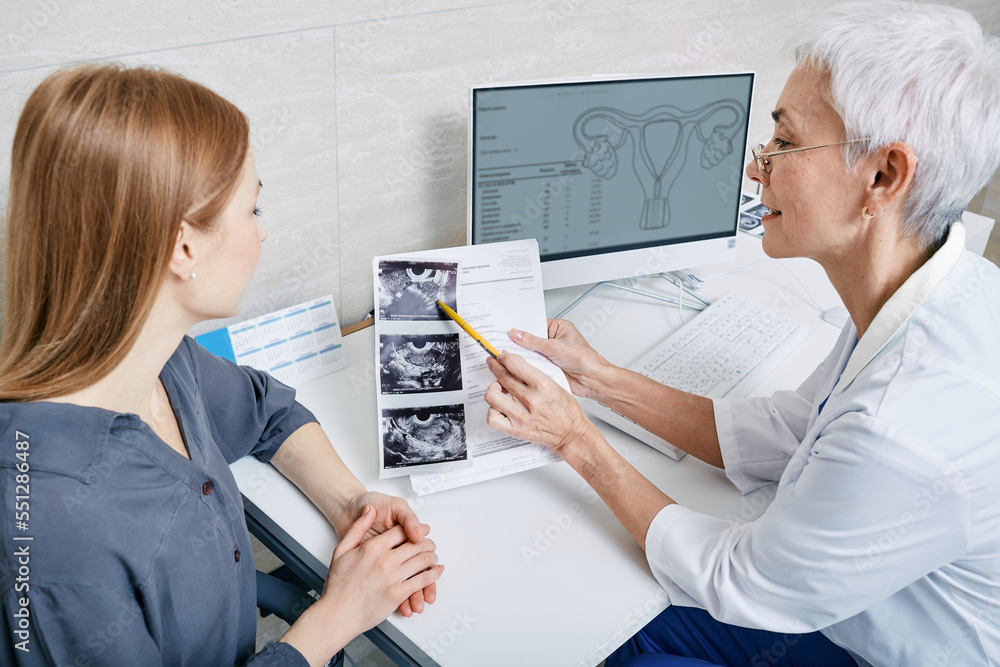 Gynecologist showing woman ultrasound of her ovaries during female ...