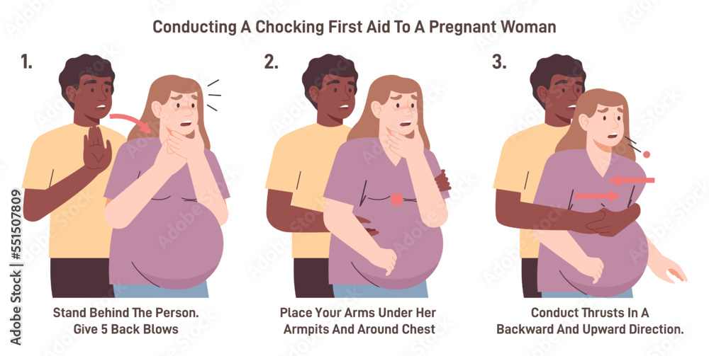 Choking first aid for pregnant woman. Heimlich maneuver procedure Stock Vector | Adobe Stock