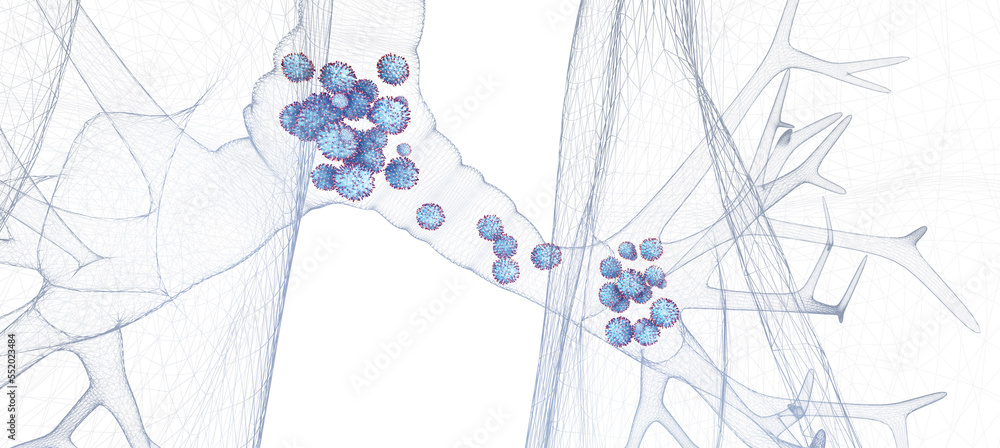 Respiratory syncytial virus (RSV) in the respiratory tract. The RSV ...