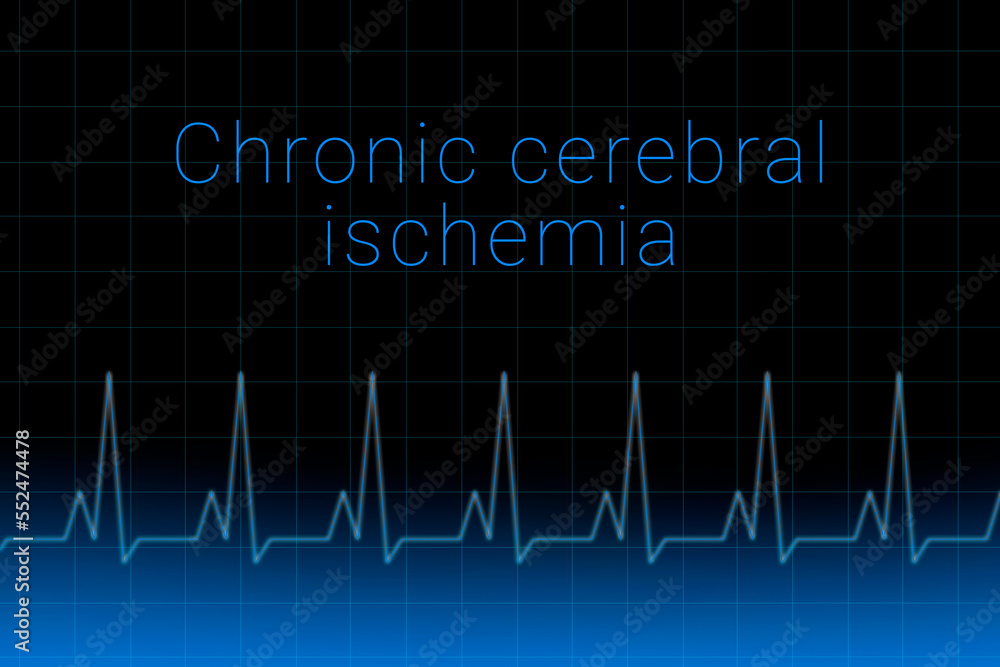 Chronic cerebral ischemia disease. Chronic cerebral ischemia logo on a ...