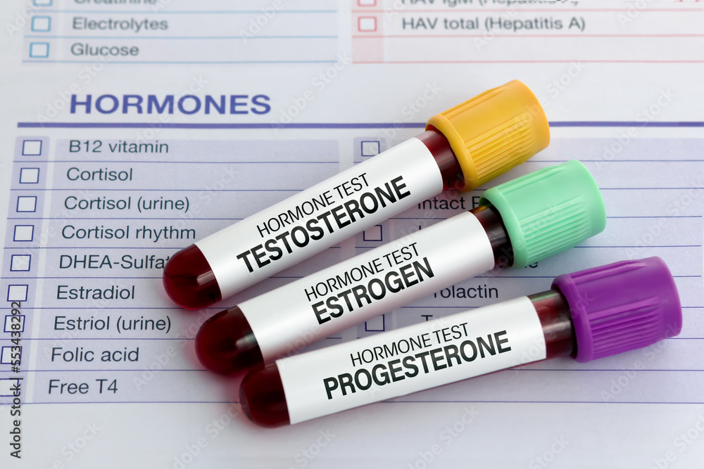 samples of Blood for sexual hormones Analysis Testosterone, Estrogen ...