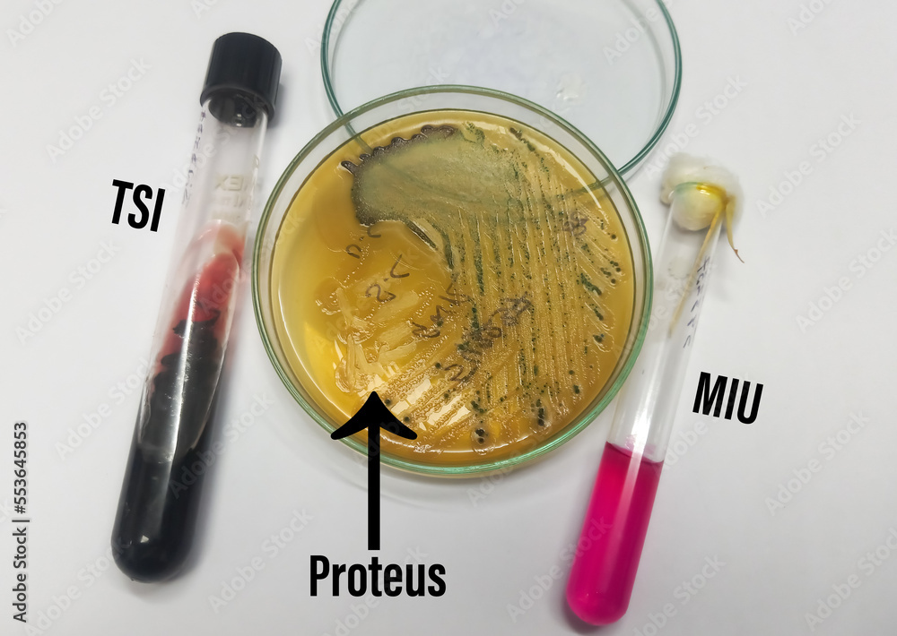 Bacteria culture growth on hichrome-uti agar media plate in ...