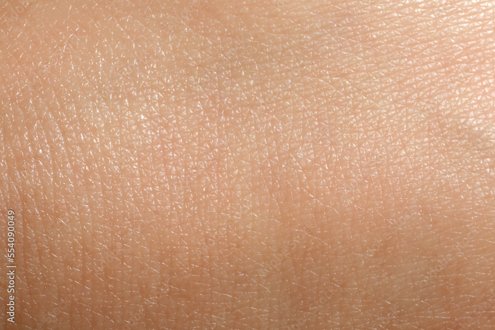 Closeup view of dry human skin as background Stock Photo | Adobe Stock