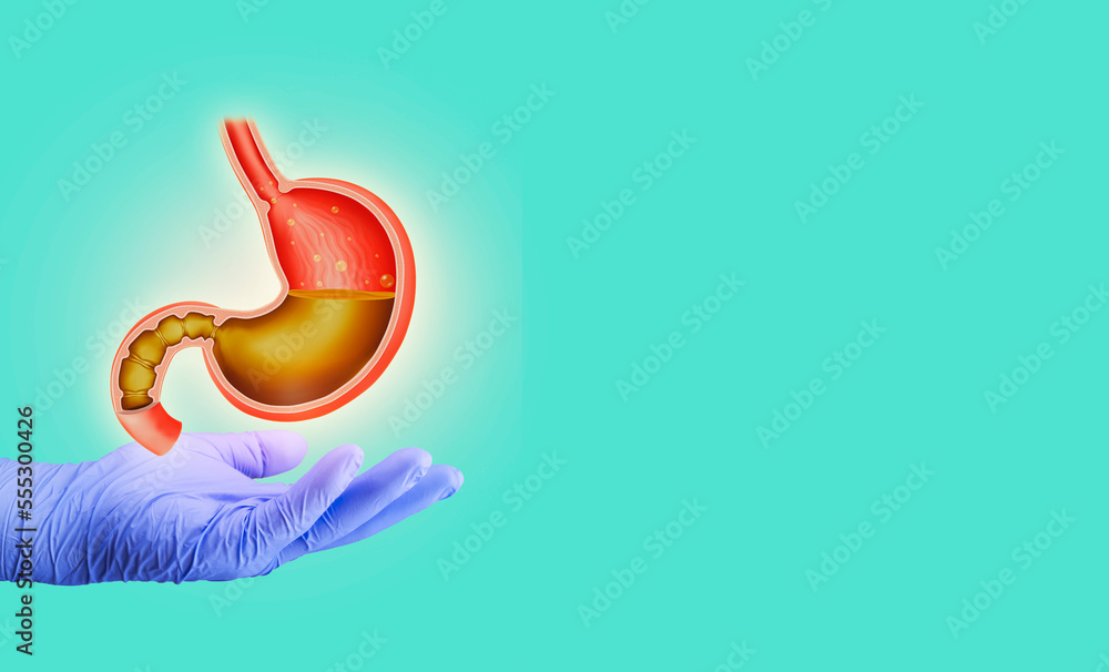 Stock-Foto „Stomach ache and epigastric abdominal pain, fire in the ...