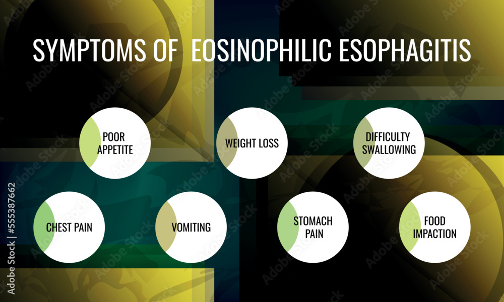 symptoms of Eosinophilic esophagitis. Vector illustration for medical ...