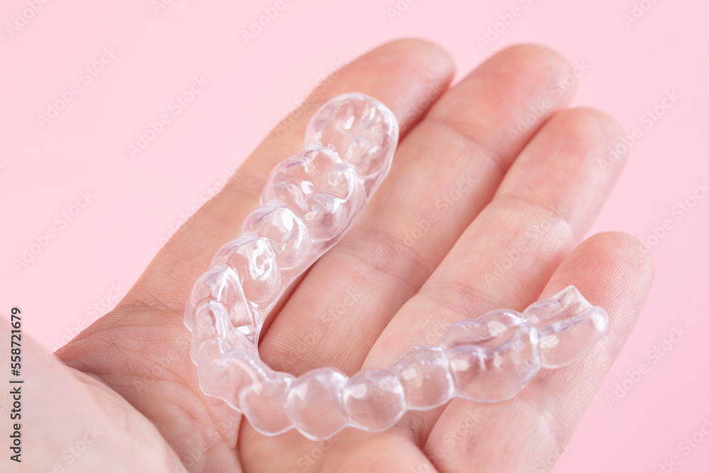 Occlusal Splint, clean brace, orthodontic Stock Photo | Adobe Stock