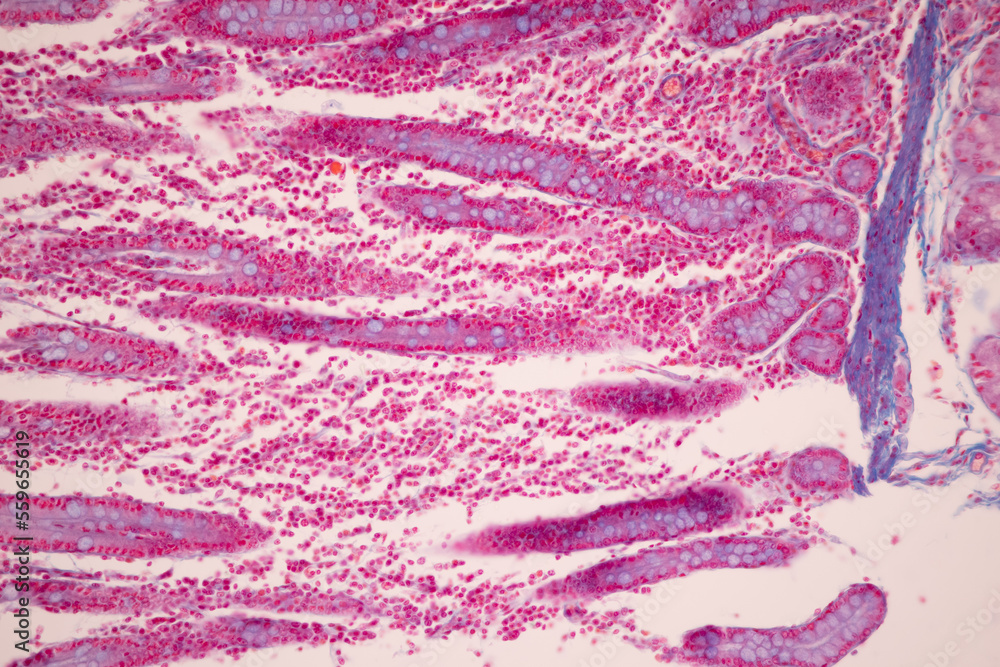Tissue of Small intestine (Duodenum), Large intestine Human and Stomach ...