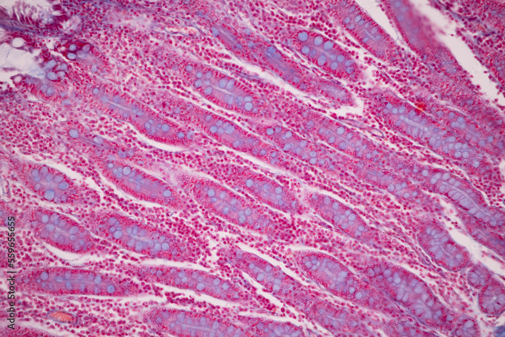 Tissue of Small intestine (Duodenum), Large intestine Human and Stomach ...