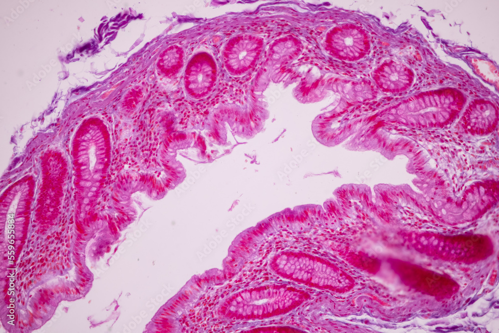 Tissue of Small intestine (Duodenum), Large intestine Human and Stomach ...