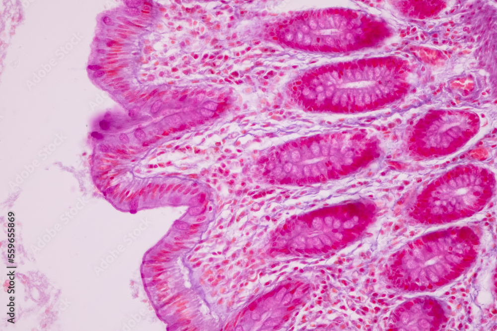 Tissue of Small intestine (Duodenum), Large intestine Human and Stomach ...