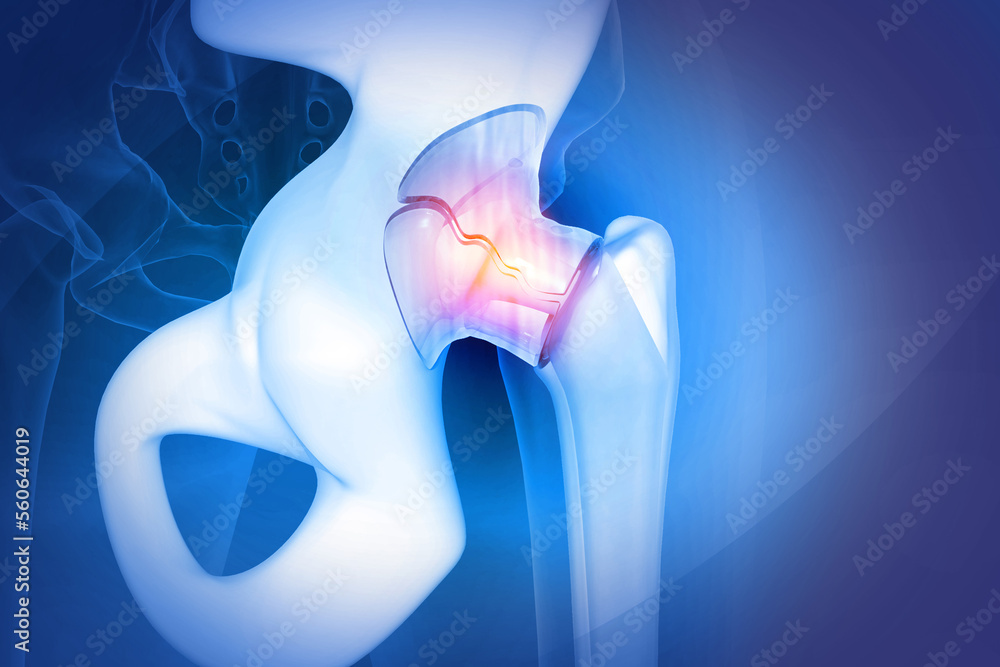 Bones of the pelvis and hip, human anatomy, femur bone joint pain ...