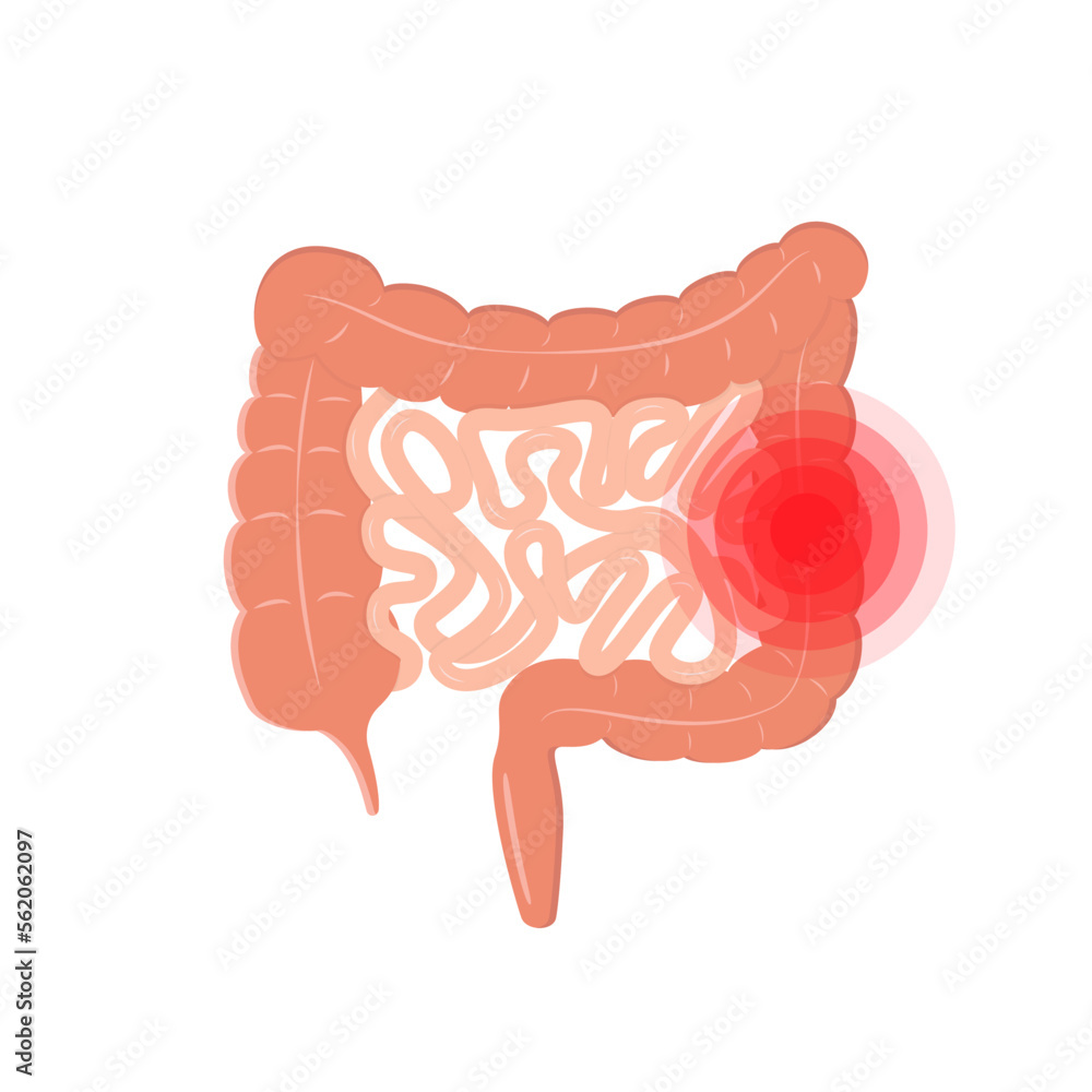 cartoon intestinal tract like irritable bowel syndrome icon Stock ...