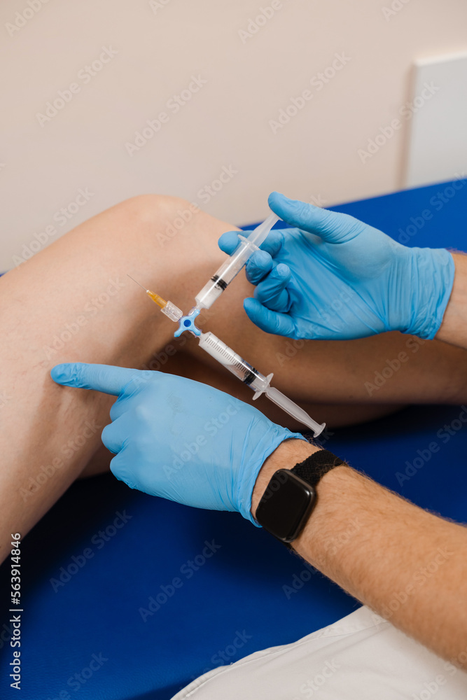 Sclerotherapy injecting into the varicose or spider vein on leg to ...