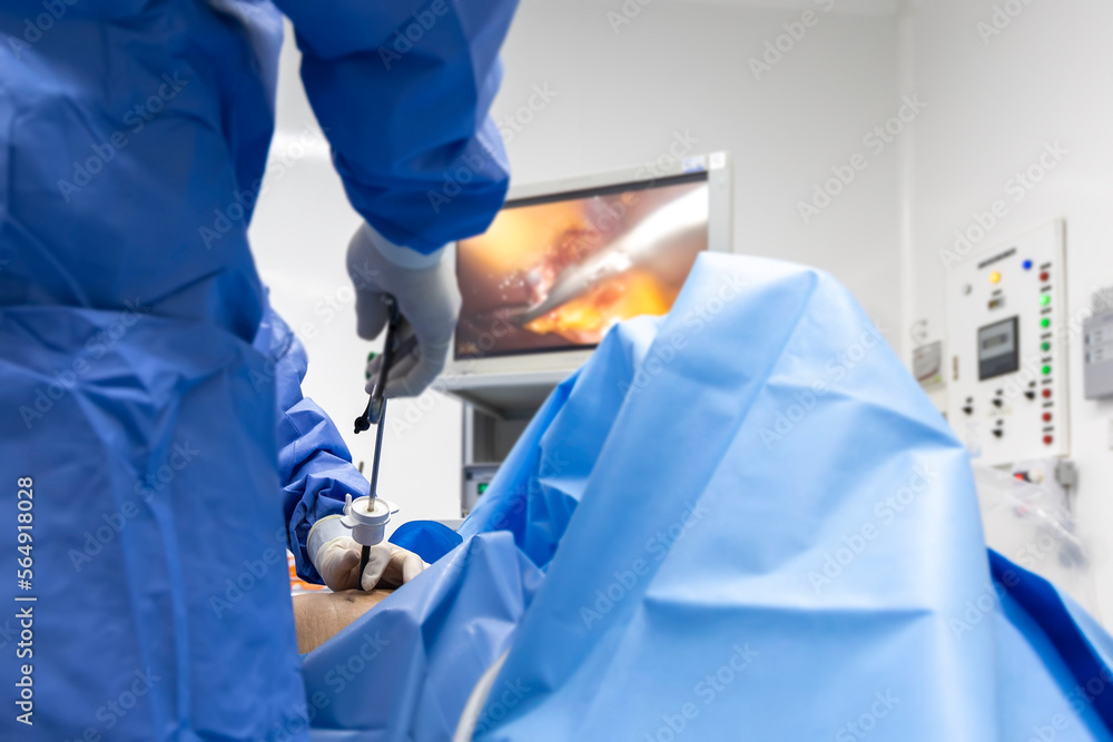 Surgeon perform laparoscopic cholecystectomy in gall stone patient with ...