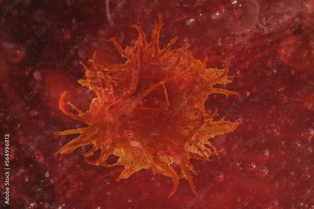 Magnification of a carcinoma cell Stock Photo | Adobe Stock